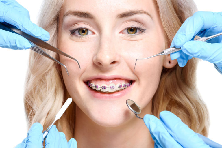 Aparat Dentar Metalic: Indicații, Tratament și Costuri - LLL Dental